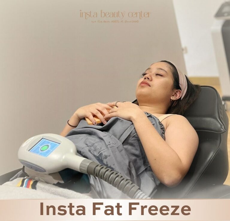 Insta Fat Freeze: Rasakan Sensasi Dingin untuk Buang Lemak Tanpa ...